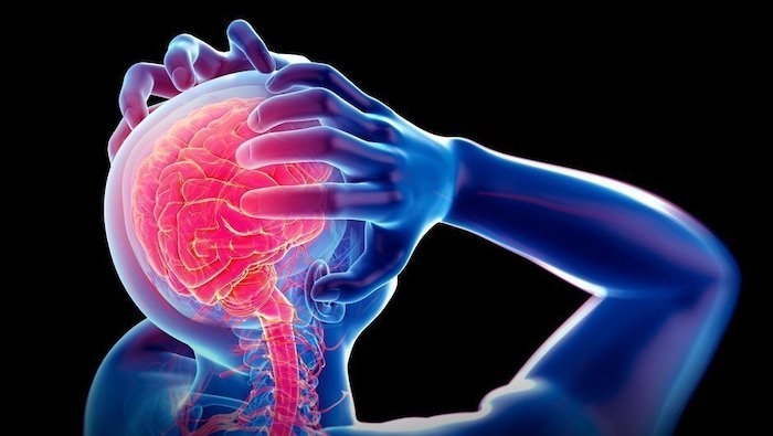 Beyincik Sarkması - Op. Dr. Halit Togay